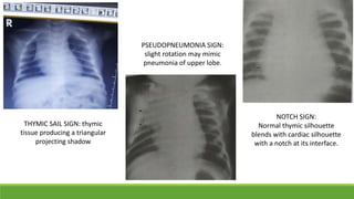 x ray approach for pediatrics and diagnosis | PPTX