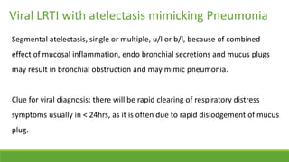 x ray approach for pediatrics and diagnosis | PPTX