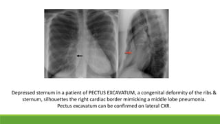 x ray approach for pediatrics and diagnosis | PPTX