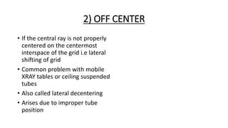 XRAY GRIDS (1).pptx
