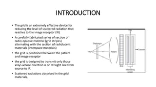 XRAY GRIDS (1).pptx