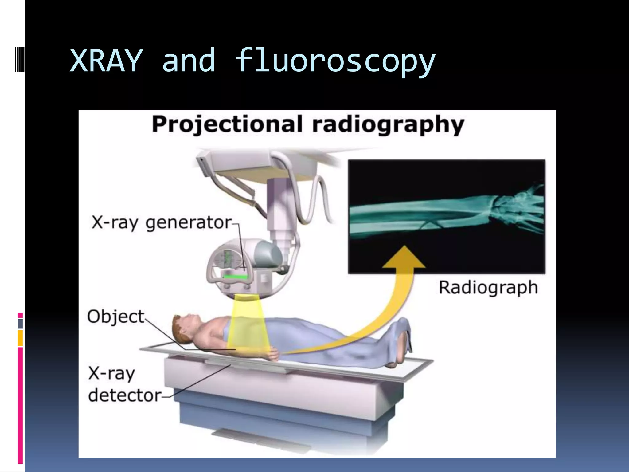 XRAY IITV intro radiology.pptx