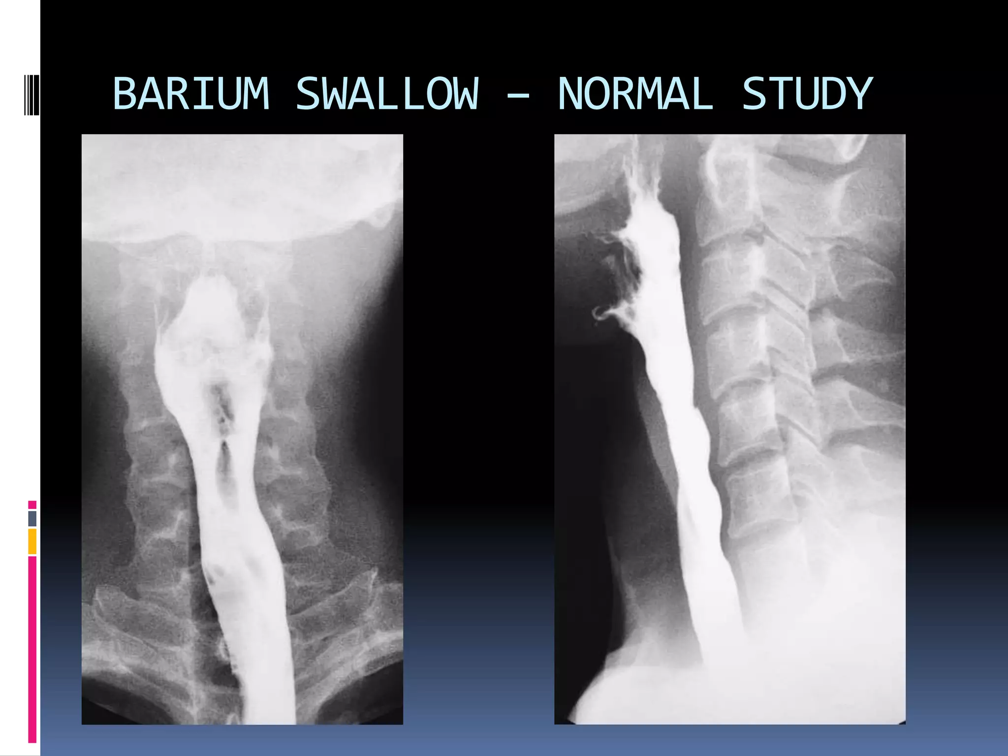XRAY IITV intro radiology.pptx
