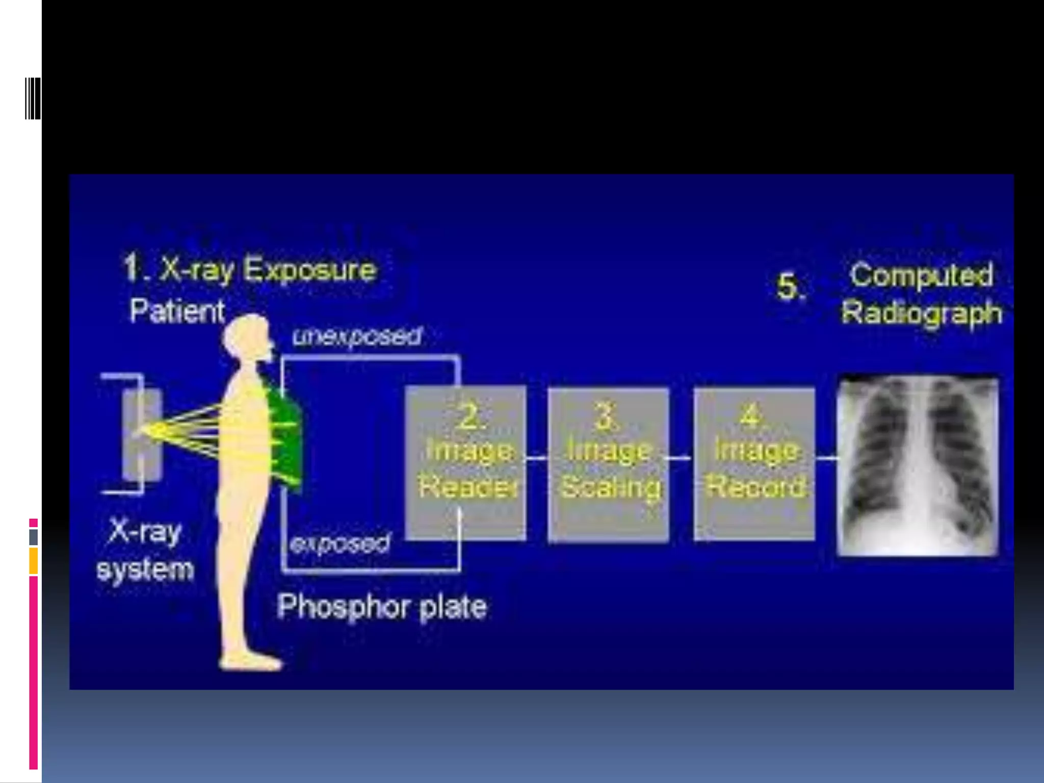 XRAY IITV intro radiology.pptx