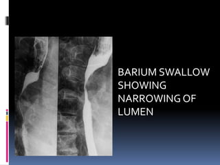 XRAY IITV intro radiology.pptx