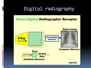 XRAY IITV intro radiology.pptx