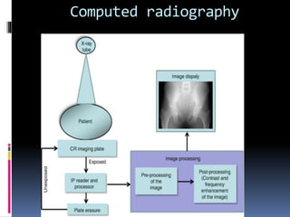 XRAY IITV intro radiology.pptx