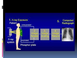 XRAY IITV intro radiology.pptx