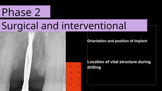 xray evaluation for dental implant .pptx