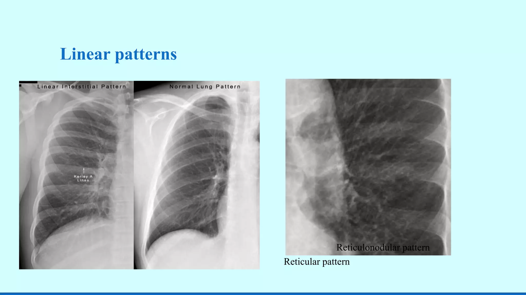 x ray intepetation.pptx