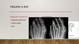 X ray Interpretation for Health Sciences.pptx