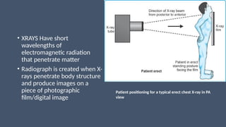 XRAY Interpretation for medical students | PPTX