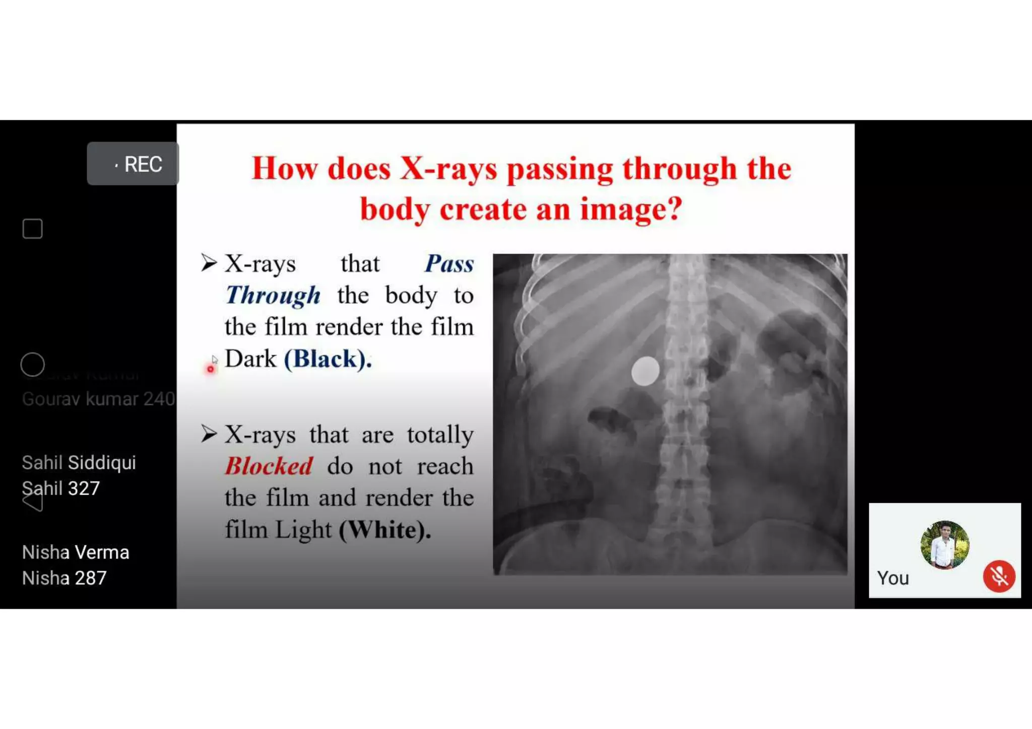 Xray interpretation mbbs anatomy | PPT