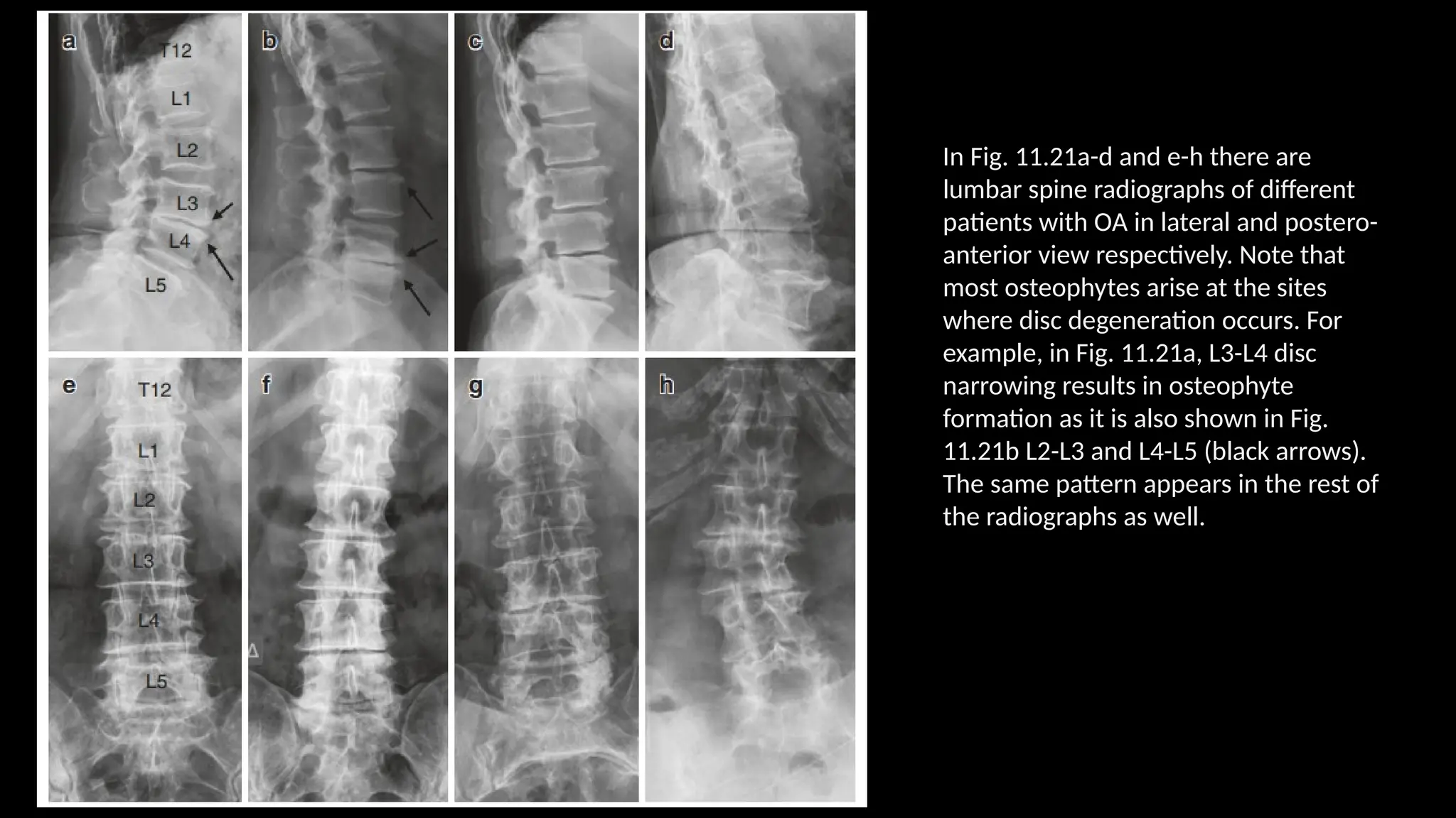 X ray Lumbosacral spine/ l s spine..... | PPTX