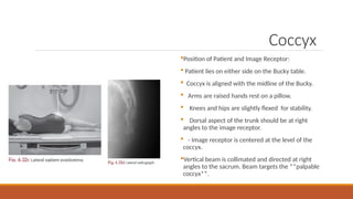 X ray Lumbosacral spine/ l s spine..... | PPTX