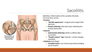 X ray Lumbosacral spine/ l s spine..... | PPTX