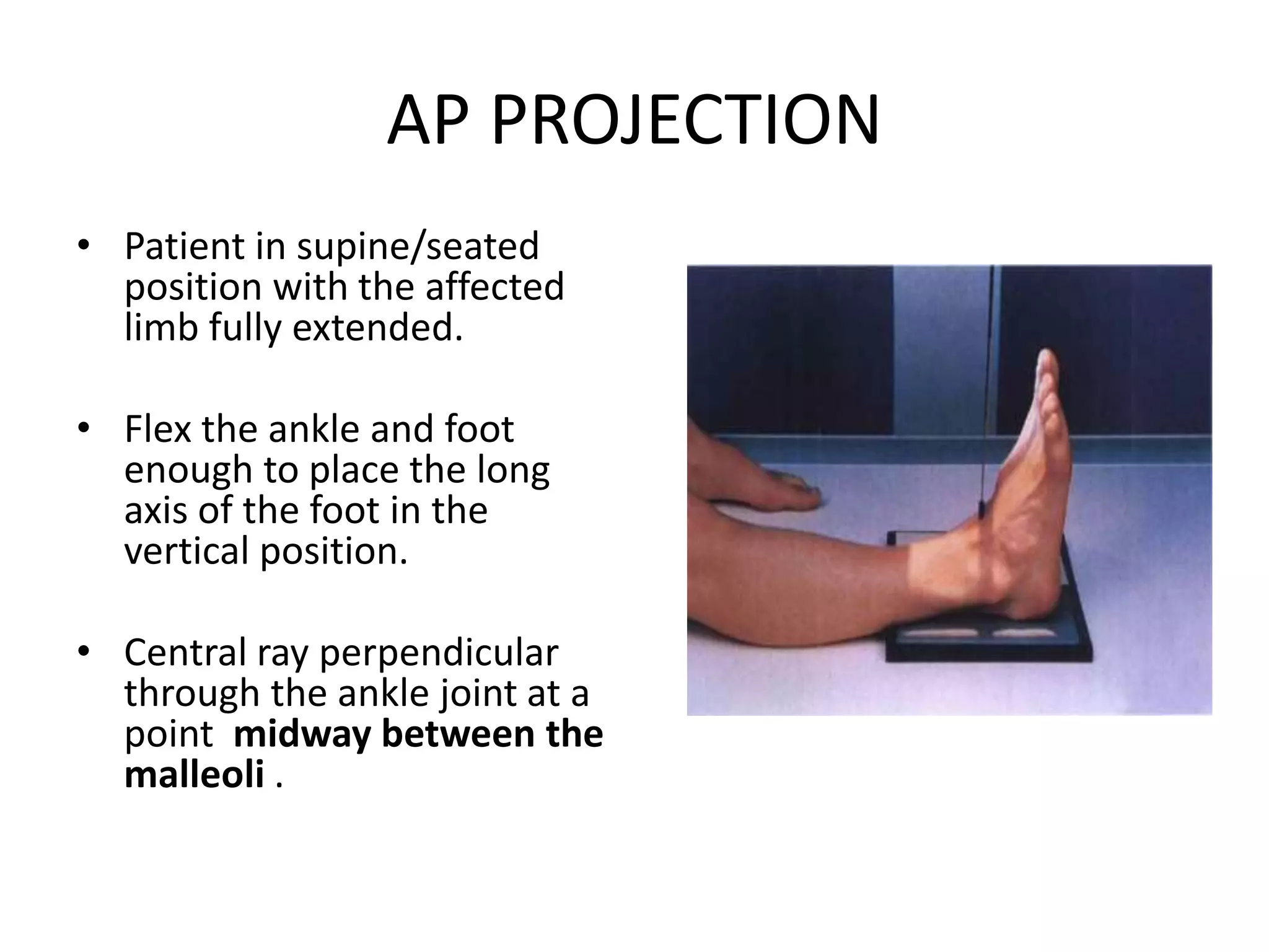 X ray of foot and ankle | PPTX