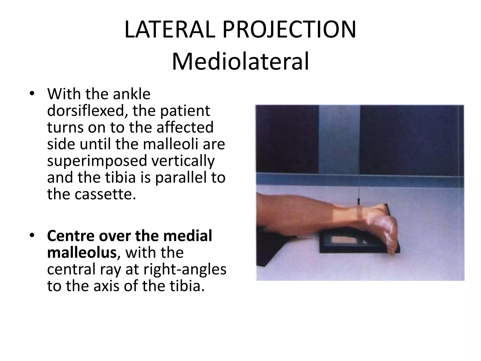 X ray of foot and ankle | PPTX