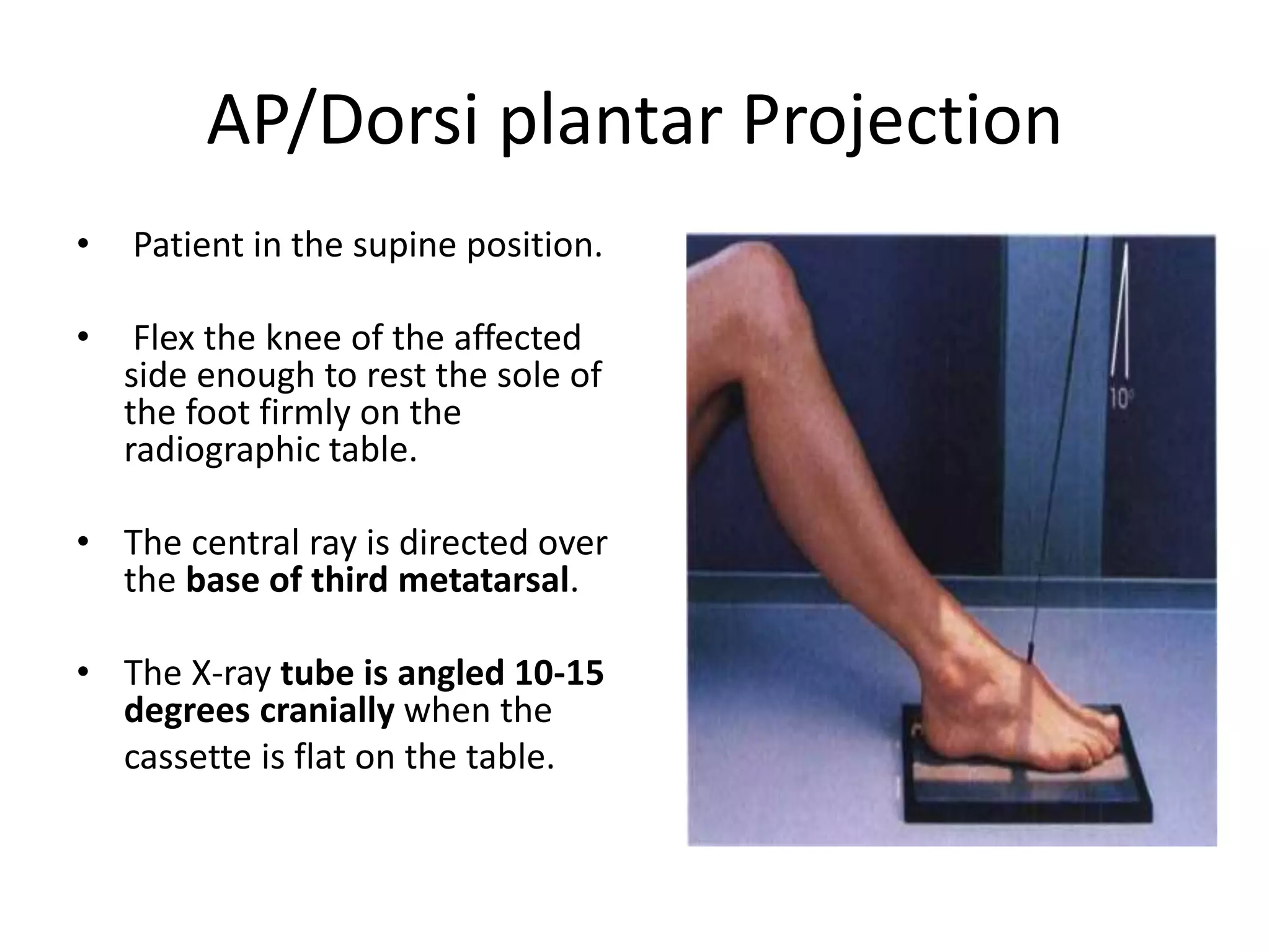 X ray of foot and ankle | PPTX