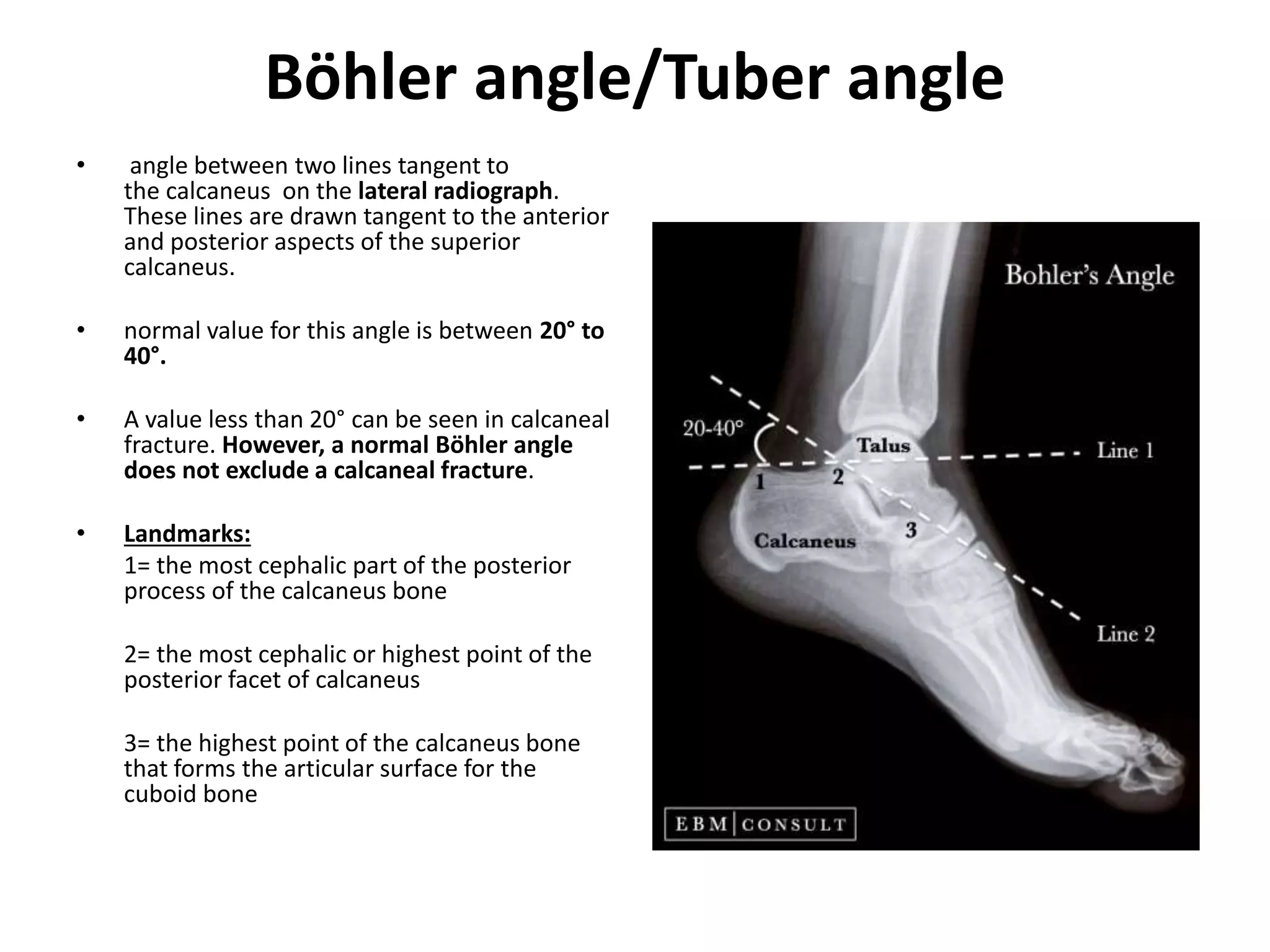 X ray of foot and ankle | PPTX