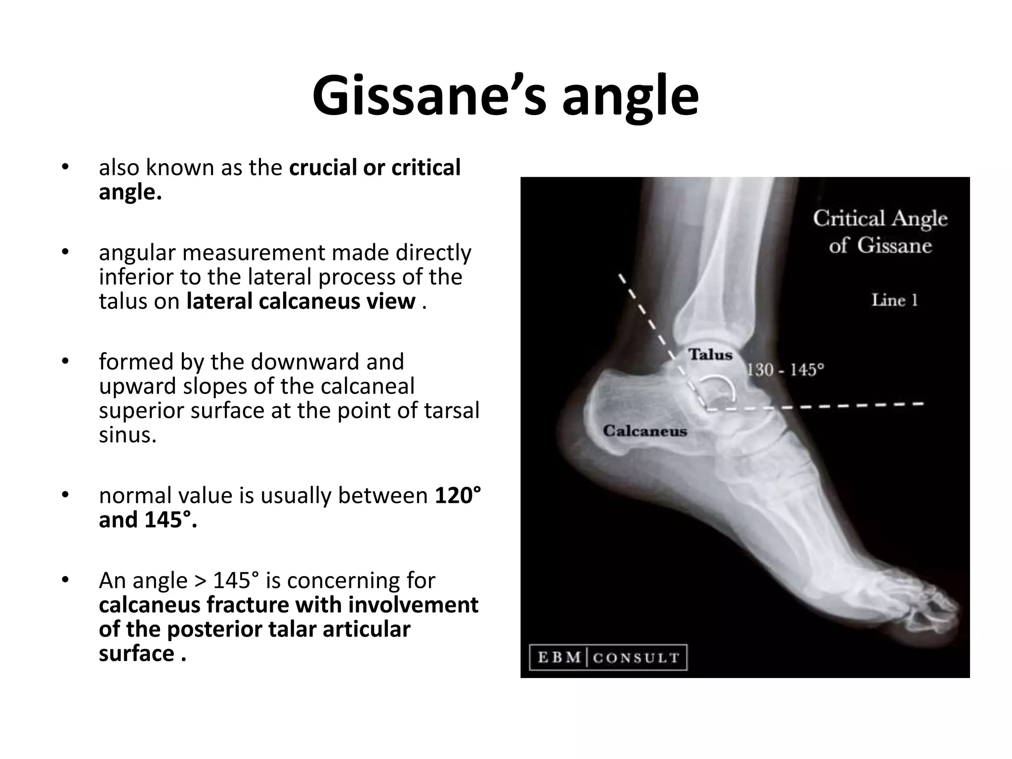 X ray of foot and ankle | PPTX