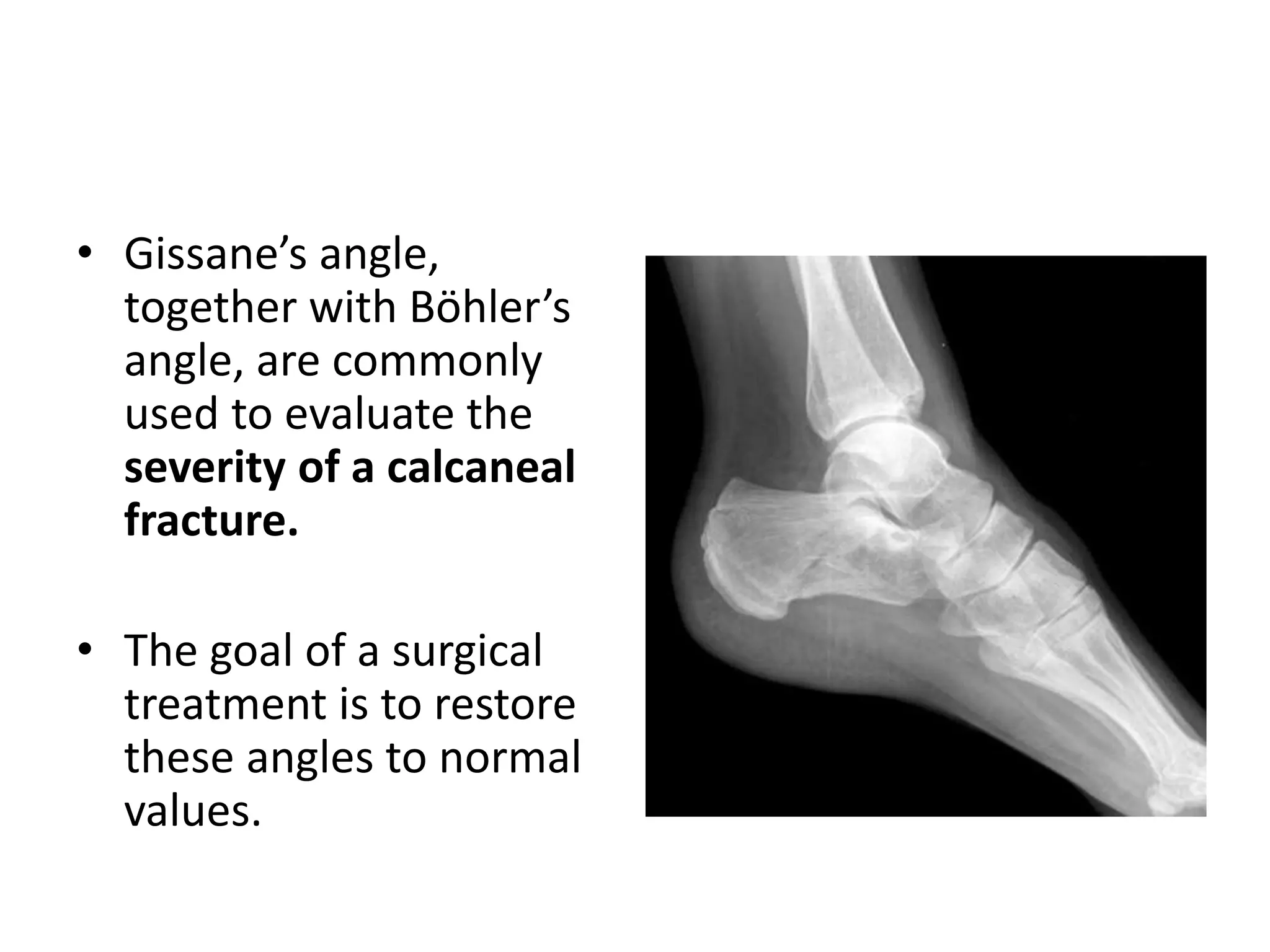 X ray of foot and ankle | PPTX