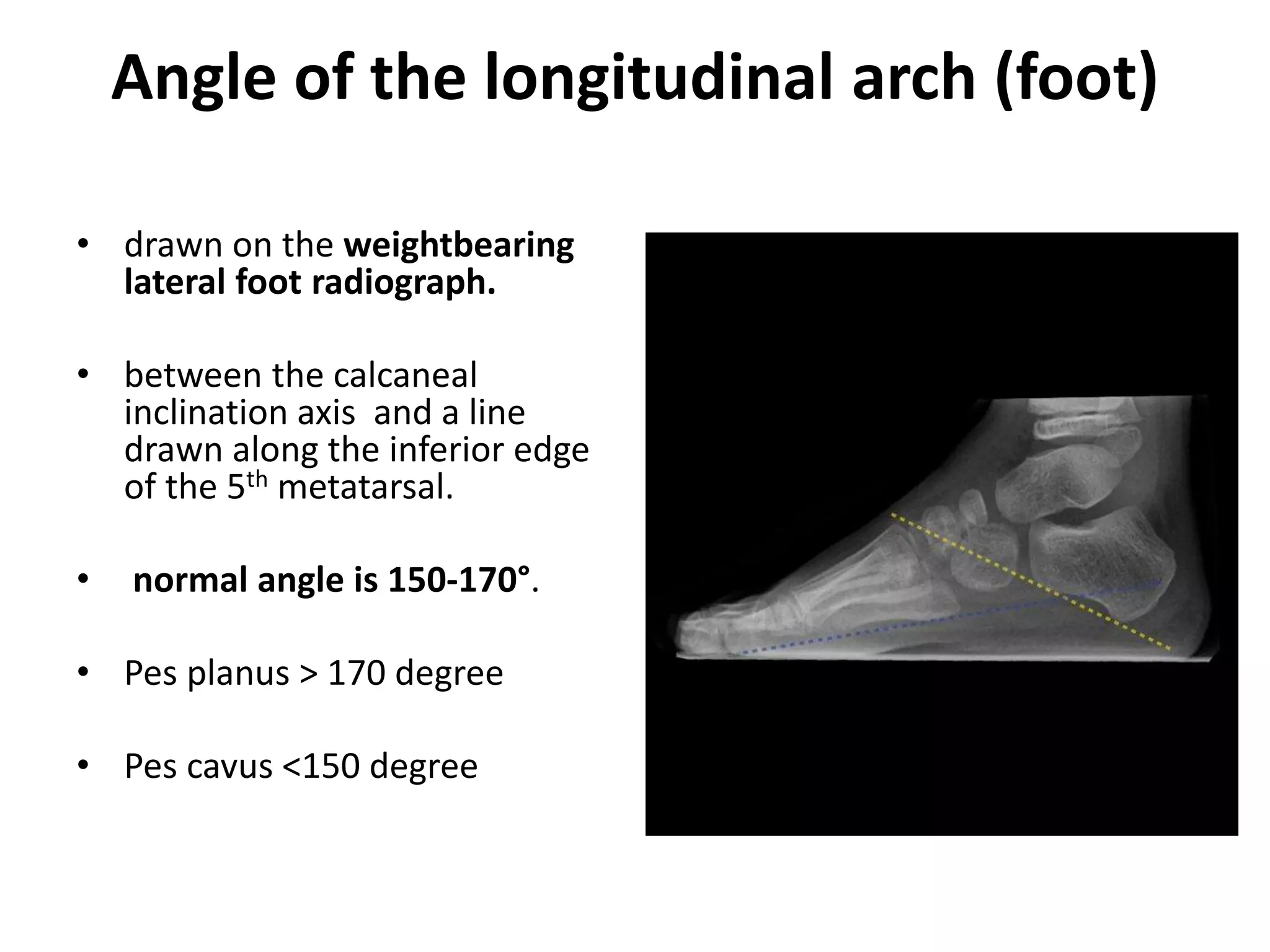 X ray of foot and ankle | PPTX