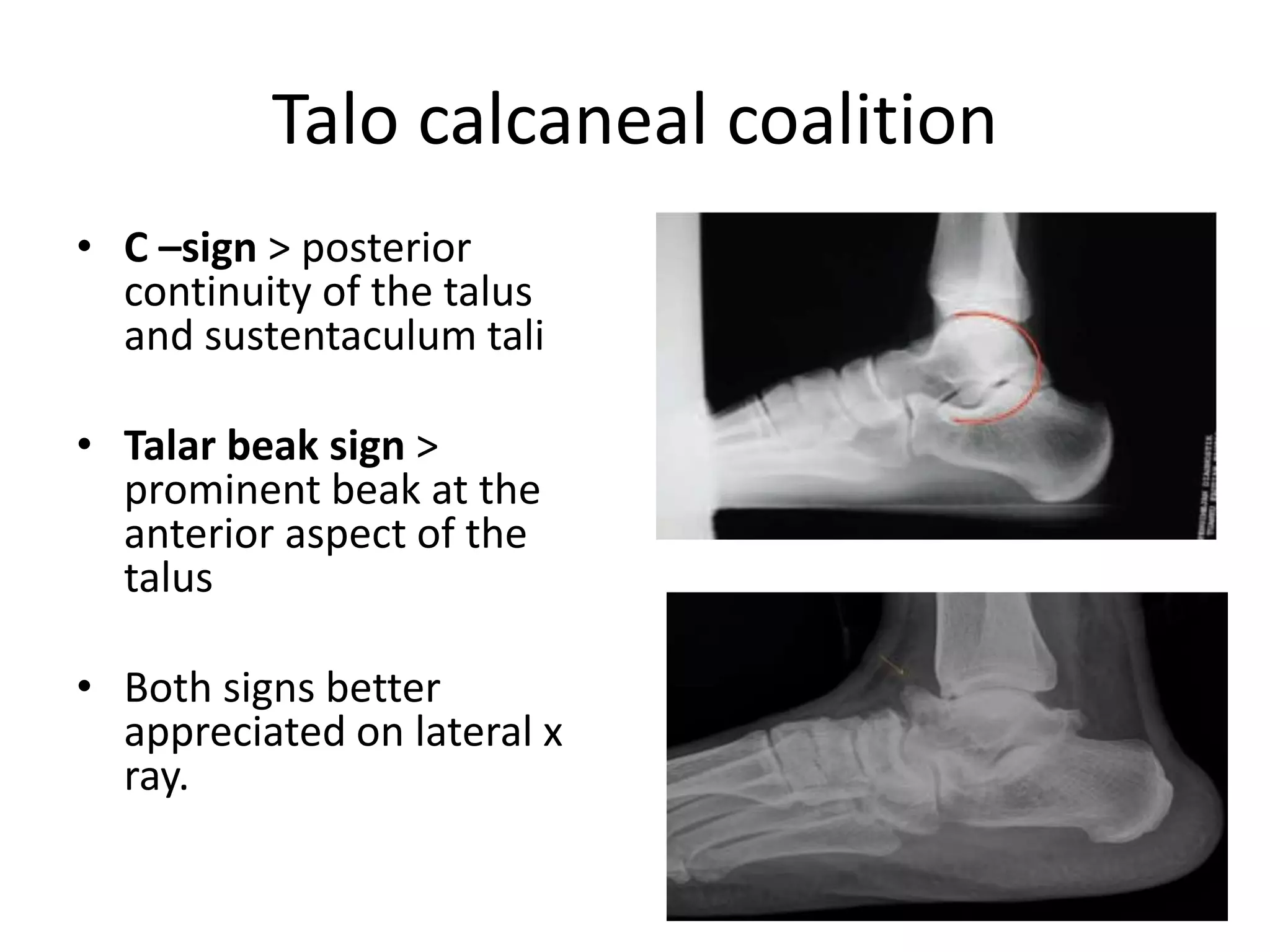 X ray of foot and ankle | PPTX