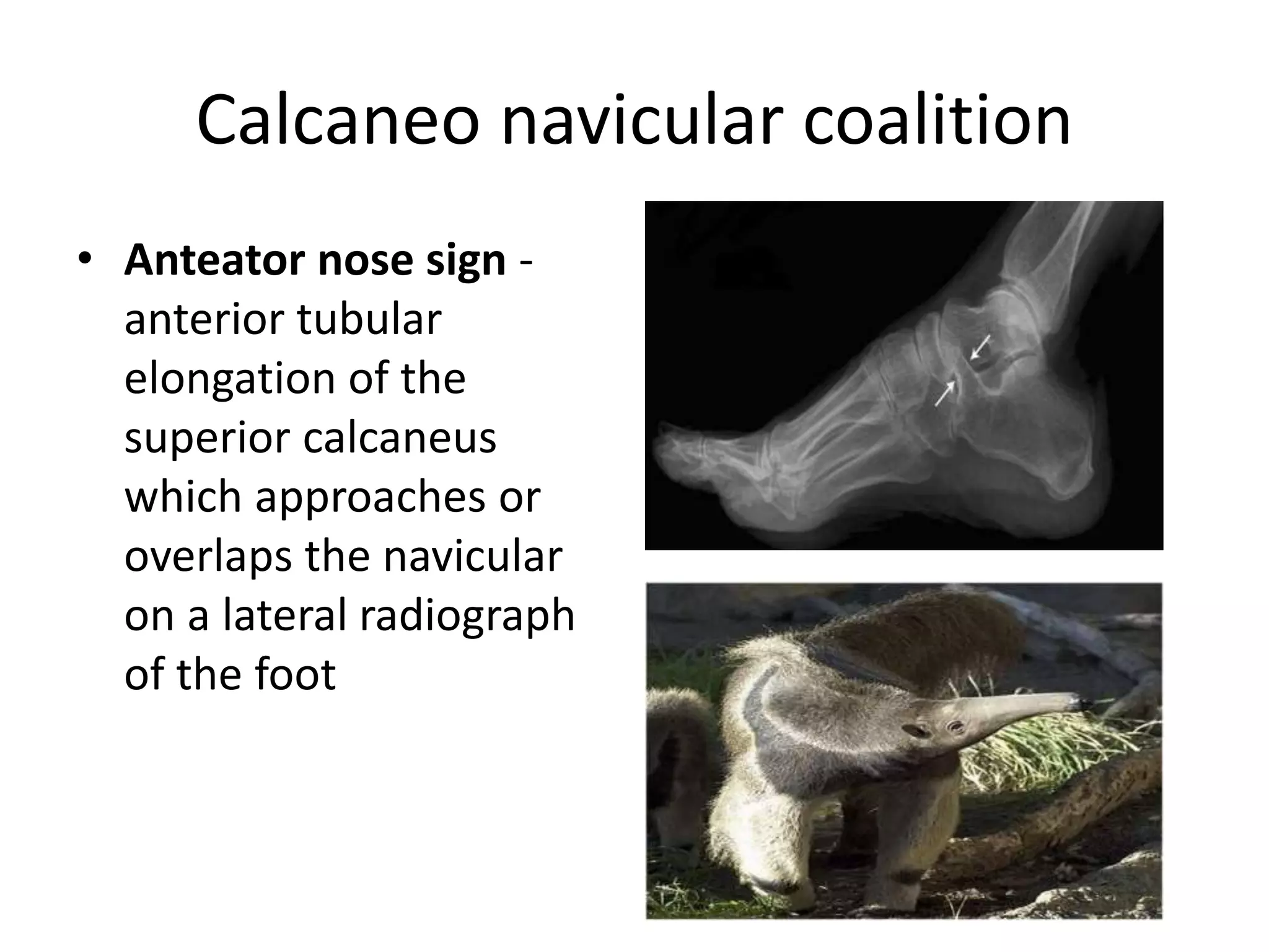 X ray of foot and ankle | PPTX