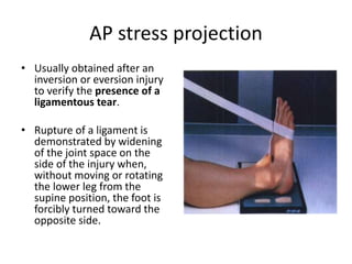 X ray of foot and ankle | PPTX