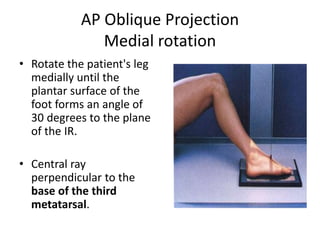 X ray of foot and ankle | PPTX
