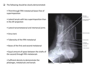 X ray of foot and ankle | PPTX