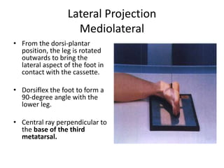 X ray of foot and ankle | PPTX