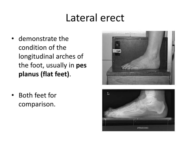 X ray of foot and ankle | PPTX | Death, Injury, or Military Conflict ...