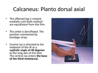 X ray of foot and ankle | PPTX
