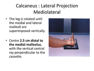 X ray of foot and ankle | PPTX