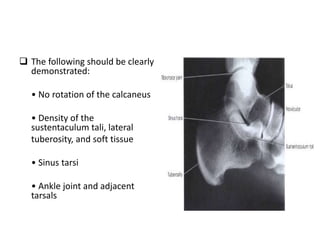 X ray of foot and ankle | PPTX