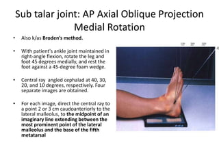 X ray of foot and ankle | PPTX