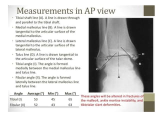 X ray of foot and ankle | PPTX