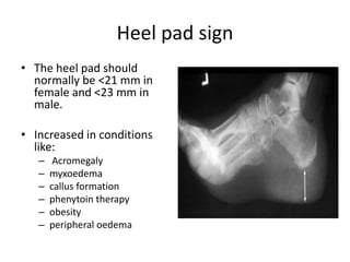 X ray of foot and ankle | PPTX