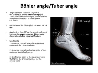 X ray of foot and ankle | PPTX