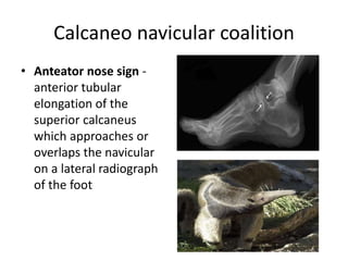 X ray of foot and ankle | PPTX