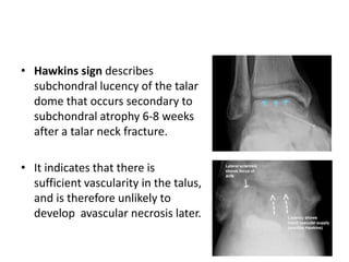 X ray of foot and ankle | PPTX