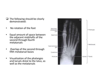 Foot X Ray Normal