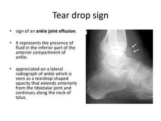 X ray of foot and ankle | PPT