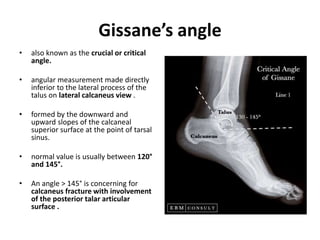 Normal Foot Xray Lateral