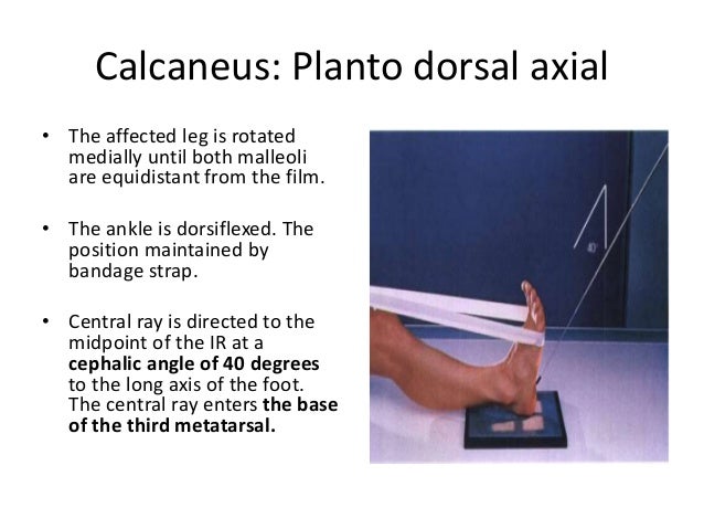 X ray of foot and ankle