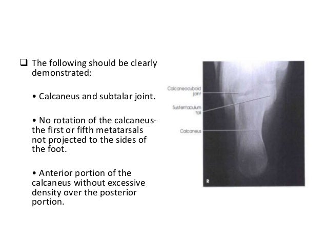 X ray of foot and ankle
