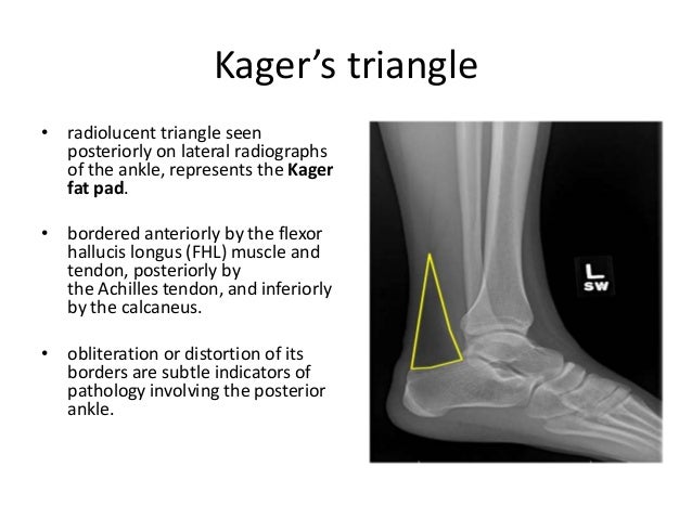 X ray of foot and ankle