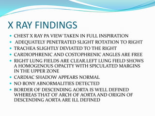 X Ray: Chest-Homogenous opacity | PPTX